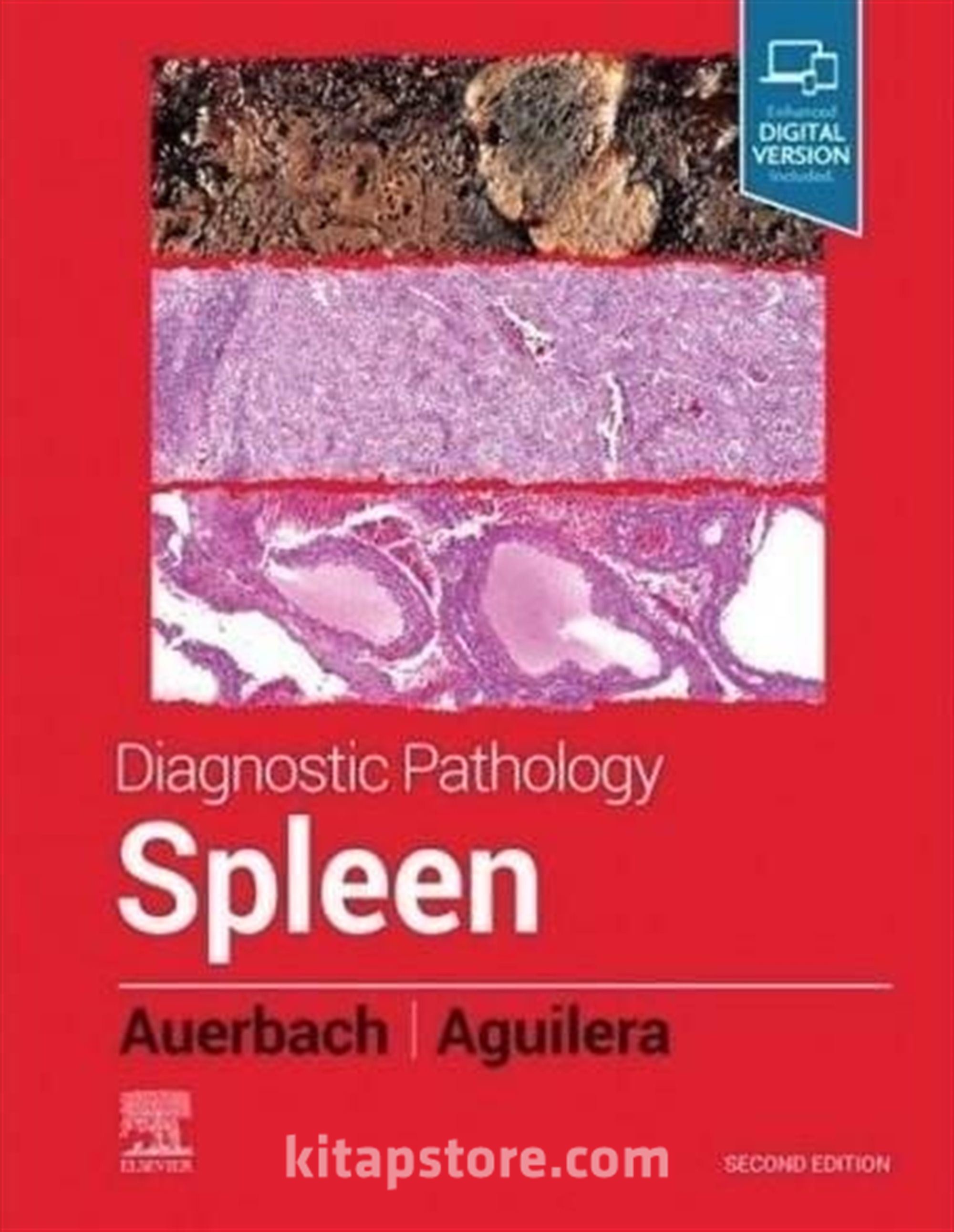 Diagnostic Pathology: Spleen, 2nd Edition - Aaron Auerbach & Nadine ...